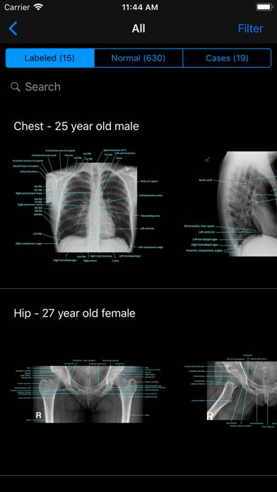 Normal X-Rays and Real Cases App Download | WorldsApps