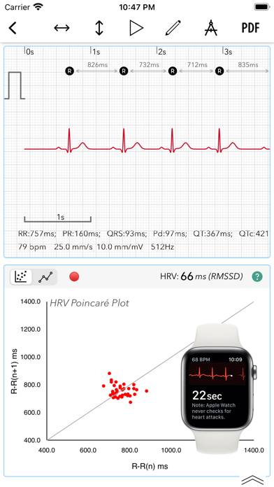 ECG plus | Analyzer for QTc & HRV App Download | WorldsApps