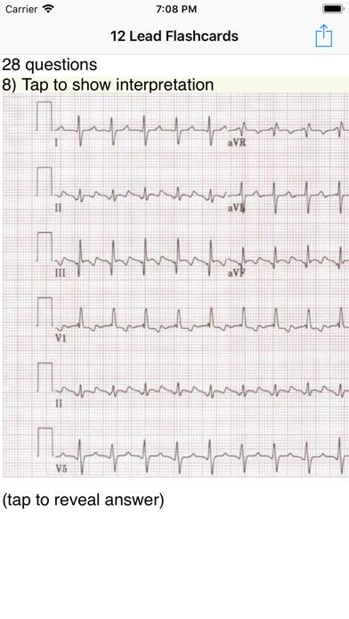 Download EKG Academy App [Updated Nov 17] | WorldsApps