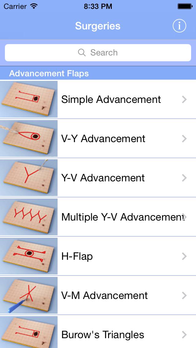 Download Surgical Flaps App [Updated Feb 23] | WorldsApps
